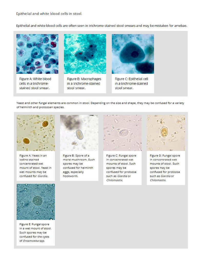 Artifacts | PDF