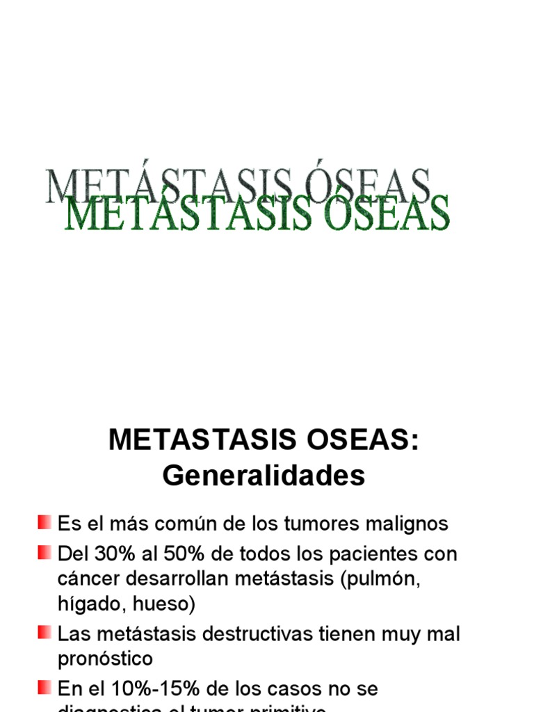 Metástasis Óseas: Diagnóstico y Tratamiento | PDF | Metástasis | Hueso