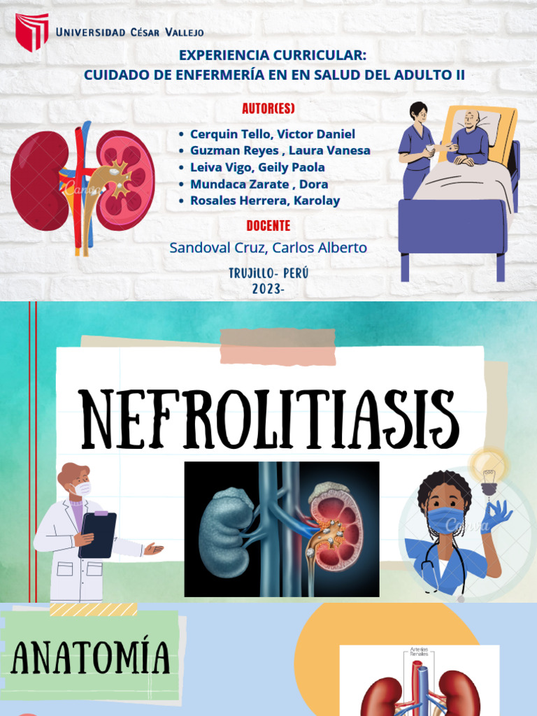 Tema Nefrolitiasis - Adulto Ii | PDF | Medicina | Sistema genitourinario