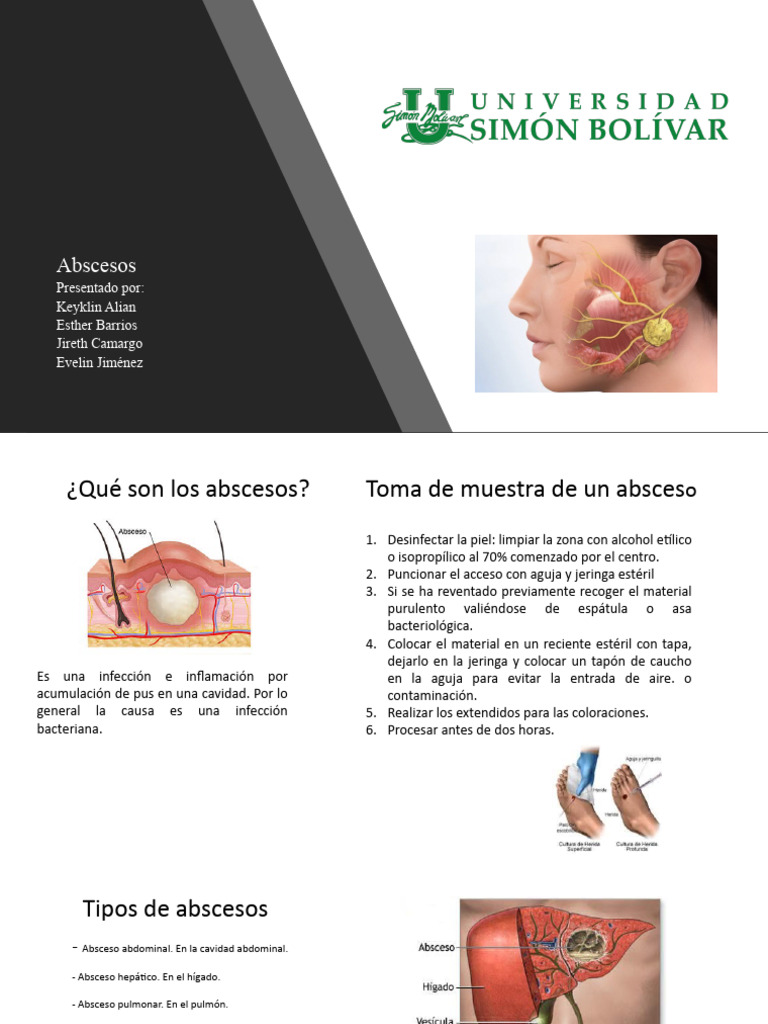 Clasificación de Abscesos y Procedimientos | PDF