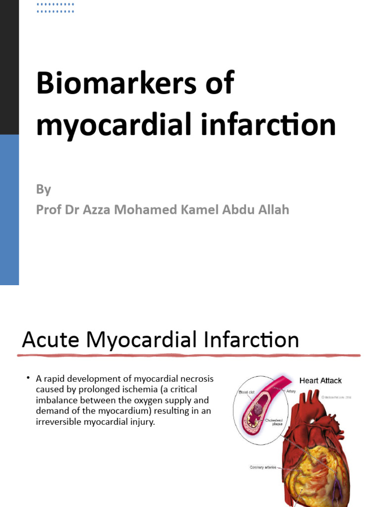 نسخة Biomarkers of Myocardial Infarction 4 | PDF | Myocardial ...