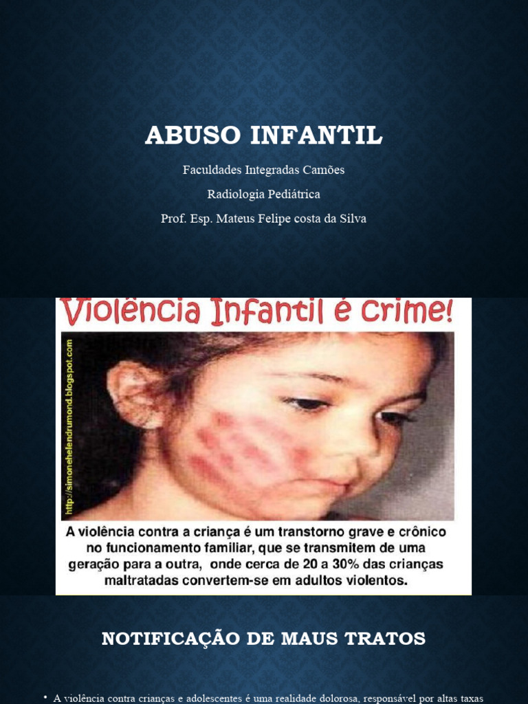 Abuso Infantil | PDF