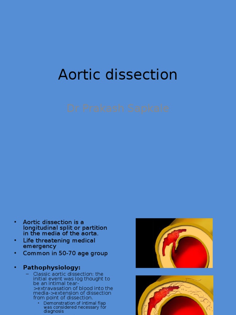 Aortic Dissection | PDF | Aorta | Cardiovascular Diseases