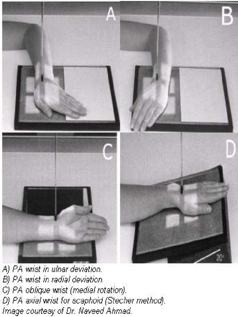 X Ray Position | PDF