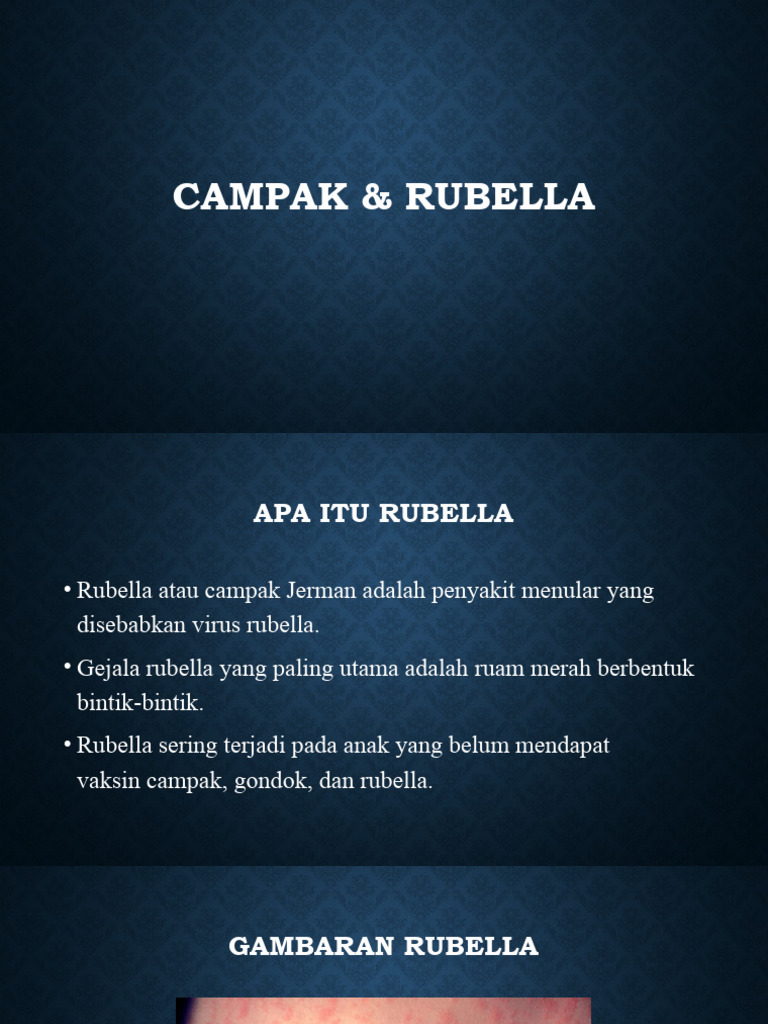Rubella | PDF
