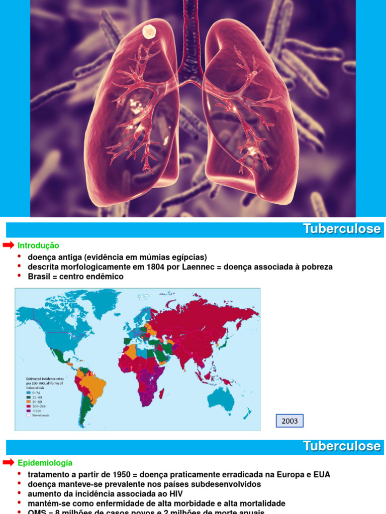 Tuberculose | PDF | Tuberculose | Mycobacterium tuberculosis