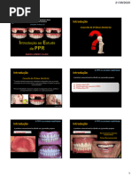 Grampos em PPR - Resumo | PDF | Dente