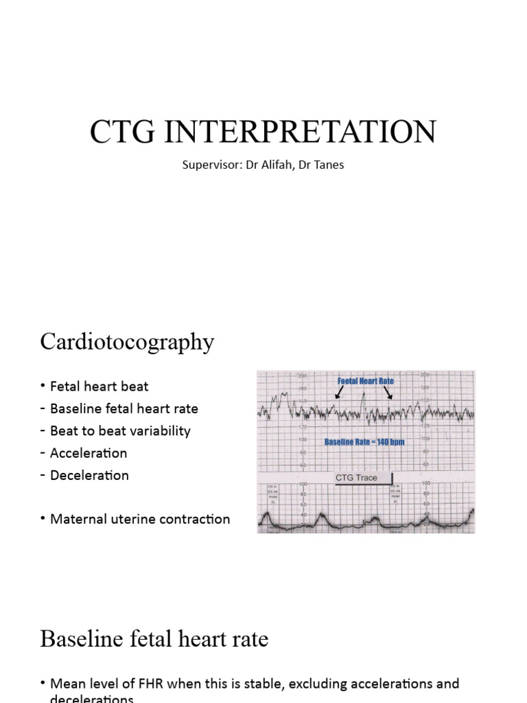 CTG Interpretation and Analysis Guide | PDF | Heart Rate | Heart