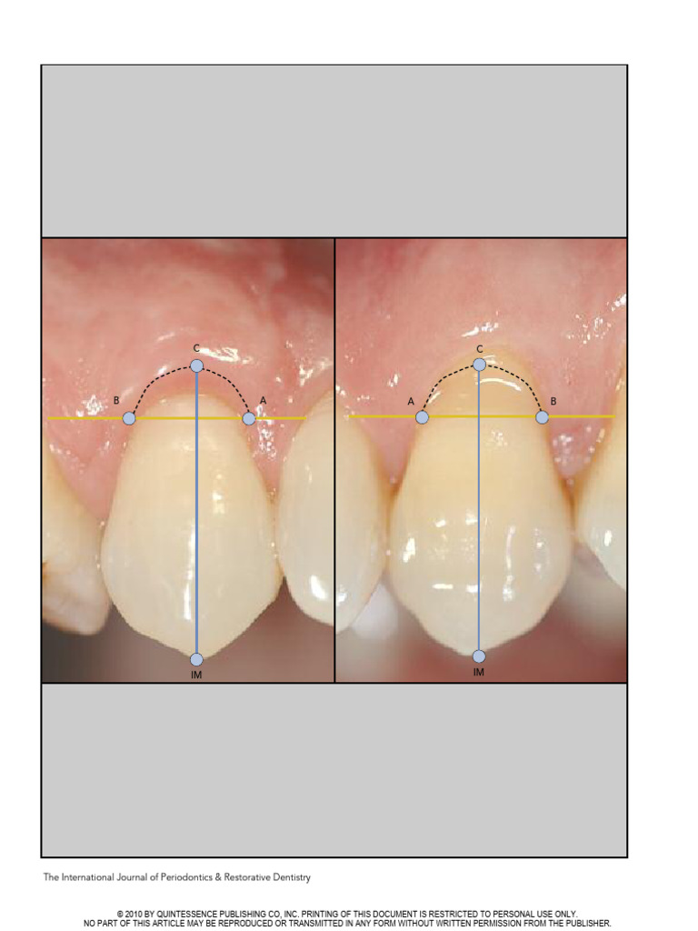 A Technique To Identify and Reconstruct The Cementoenamel Junction ...