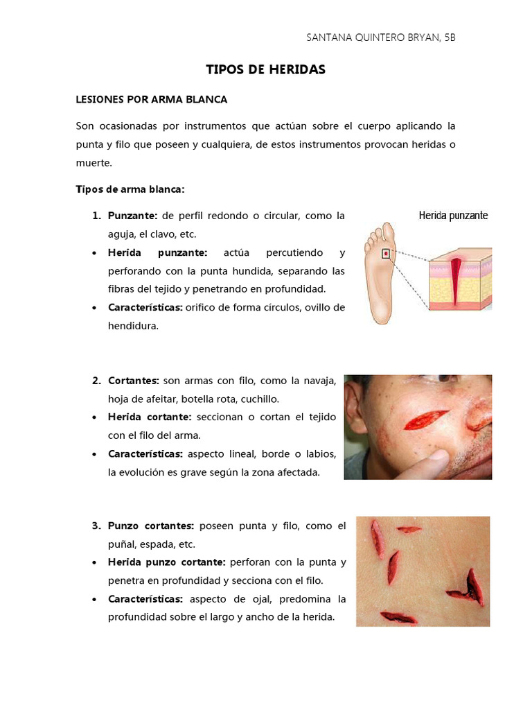 Tipos de Heridas | Descargar gratis PDF | Herida | Peligros