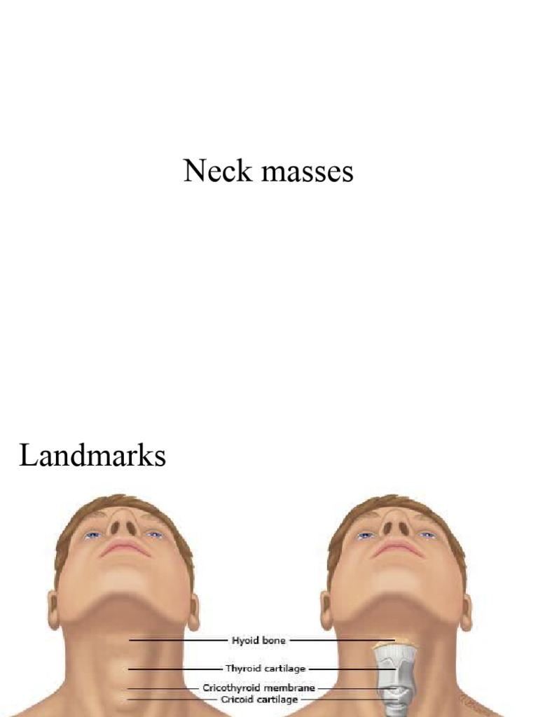 Neck Masses | PDF