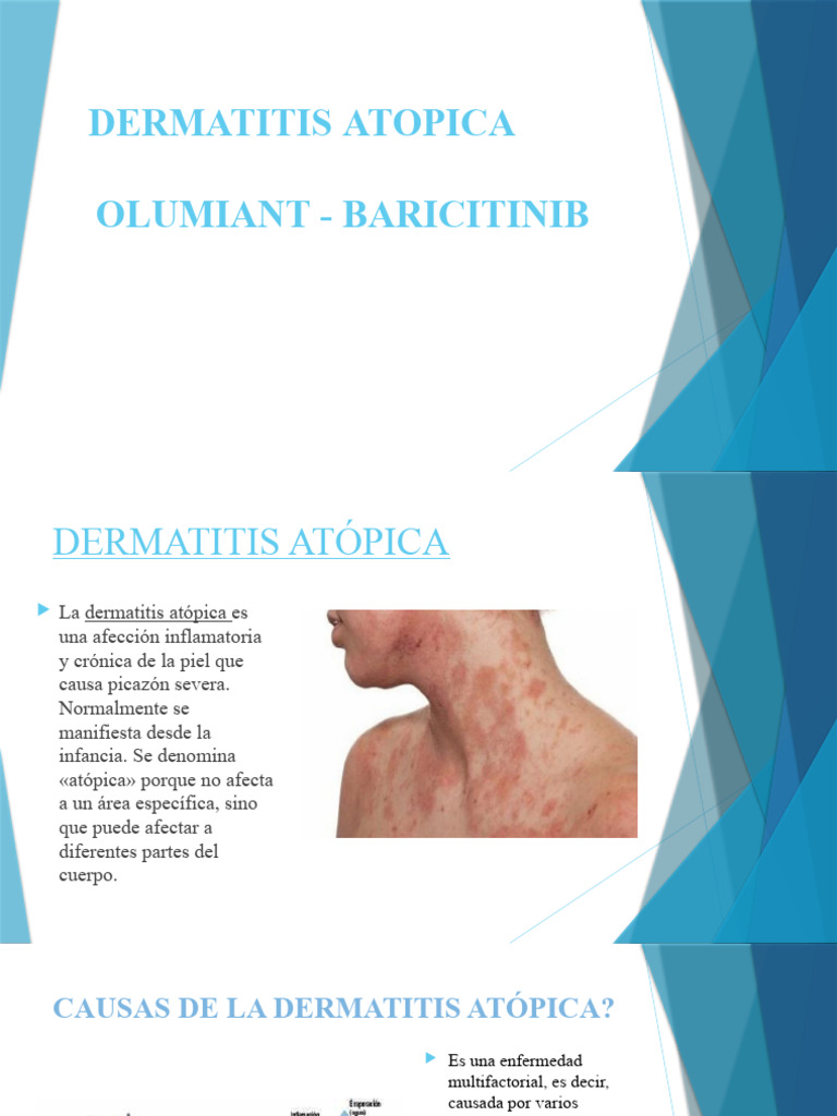 Dermatitis Atopica | PDF | Alergia | Medicina CLINICA
