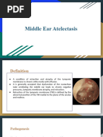 Stenger Test Procedure for Malingering | PDF | Hearing Loss | Ear