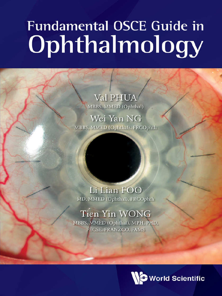 Fundamental OSCE Guide in Ophthalmology | PDF | Glaucoma | Medicine