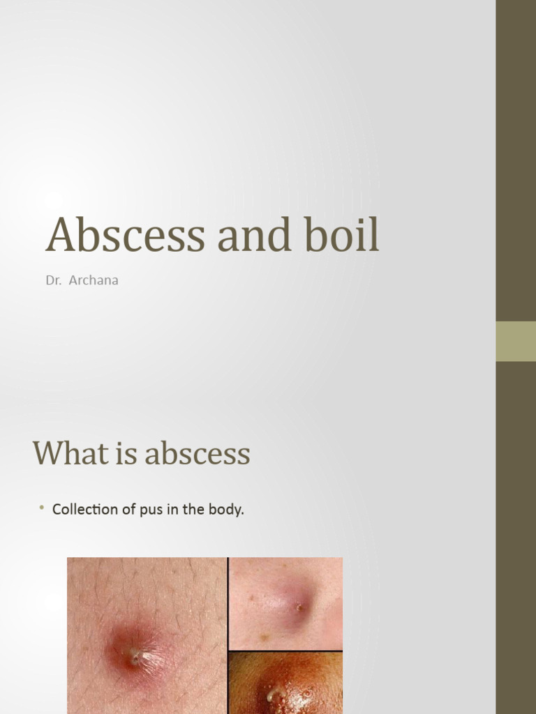 Abscess | PDF | Microbiology | Epidemiology