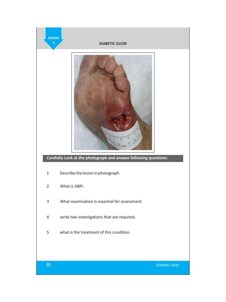 Surgical OSCE Stations Overview | PDF | Varicose Veins | Esophagus
