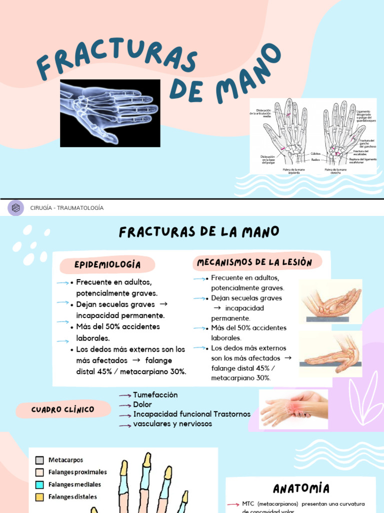 Fracturas de Mano | PDF | Mano | Enfermedades y trastornos humanos