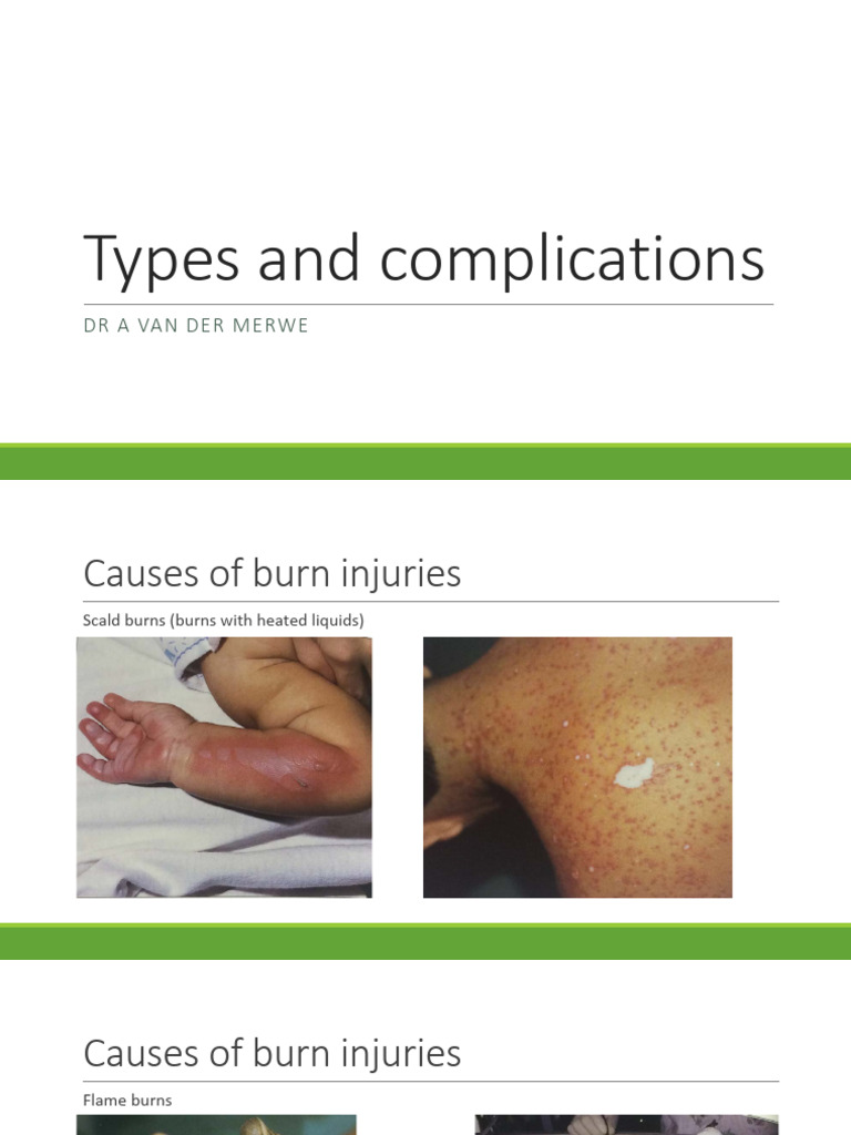 Types and Complications Burn (Physiotherapy) | PDF | Burn | Injury