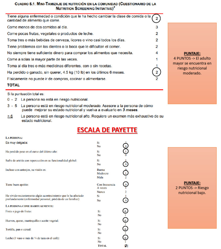 Sesión #08 - Escala de Payette y Mini Tamizaje de Nutrición | PDF