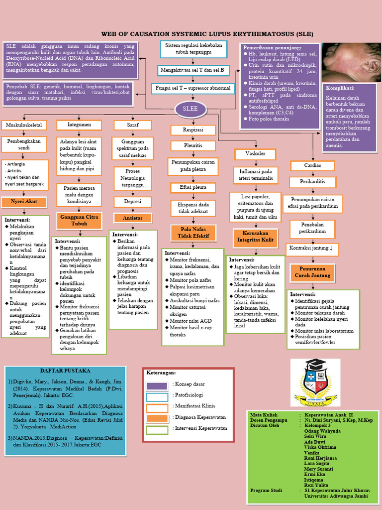 Penyebab dan Penanganan SLE | PDF