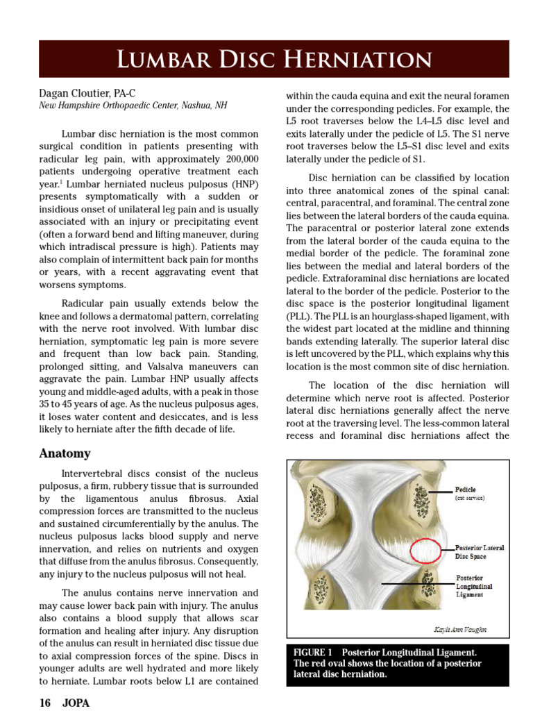 Lumbar Disc Herniation | PDF | Back Pain | Surgery