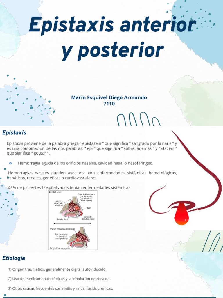 Epistaxis Anterior y Posterior | Descargar gratis PDF | Medicina ...