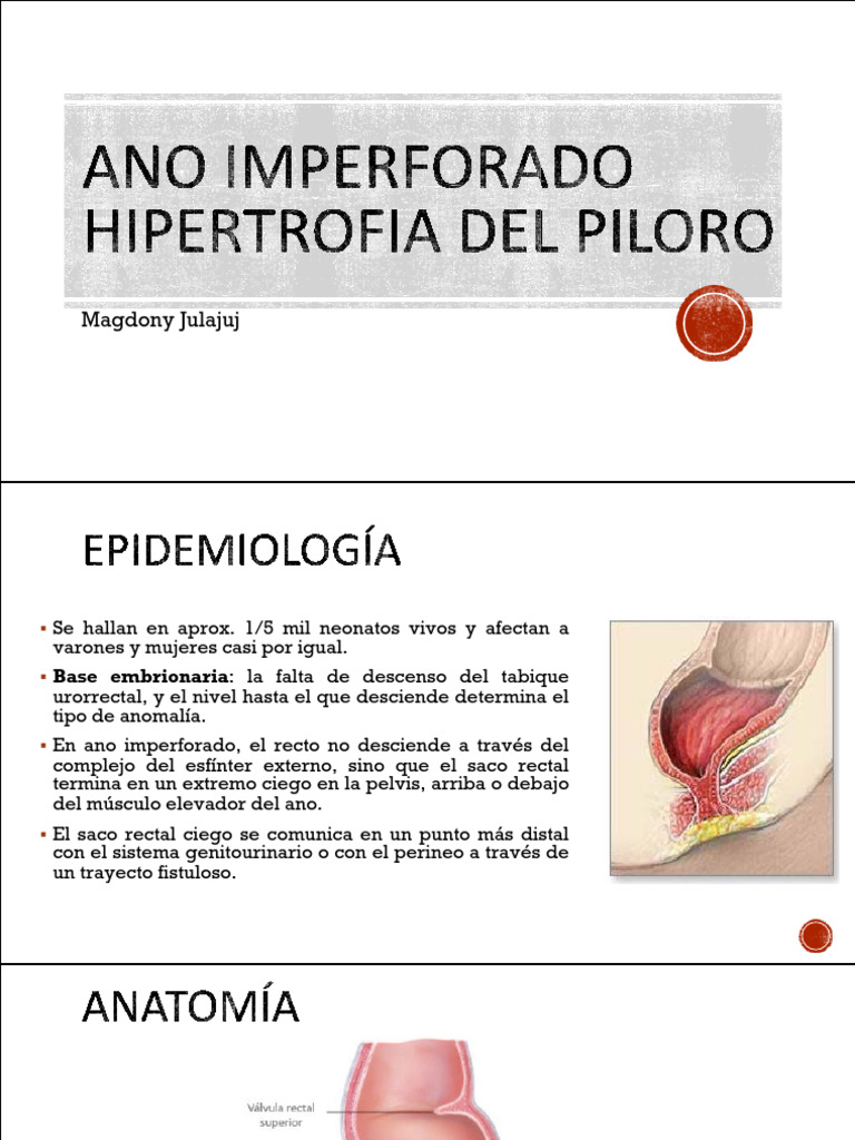 Ano Imperforado e H Piloro | PDF | Órgano (anatomía) | Gastroenterología