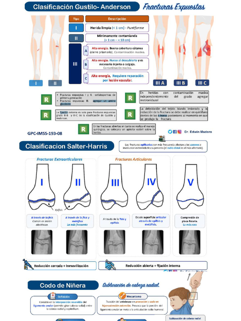TYO | PDF