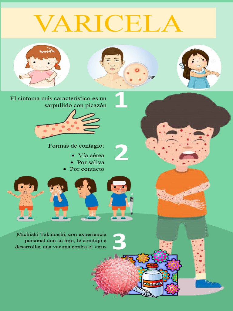 Infografía 12 - VARICELA | PDF