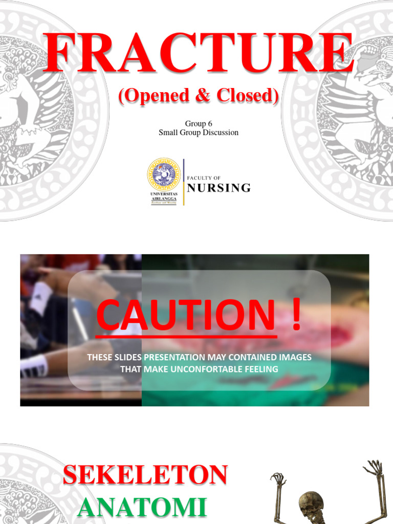 FRACTURE PDF Fix | PDF | Bone | Skeletal System