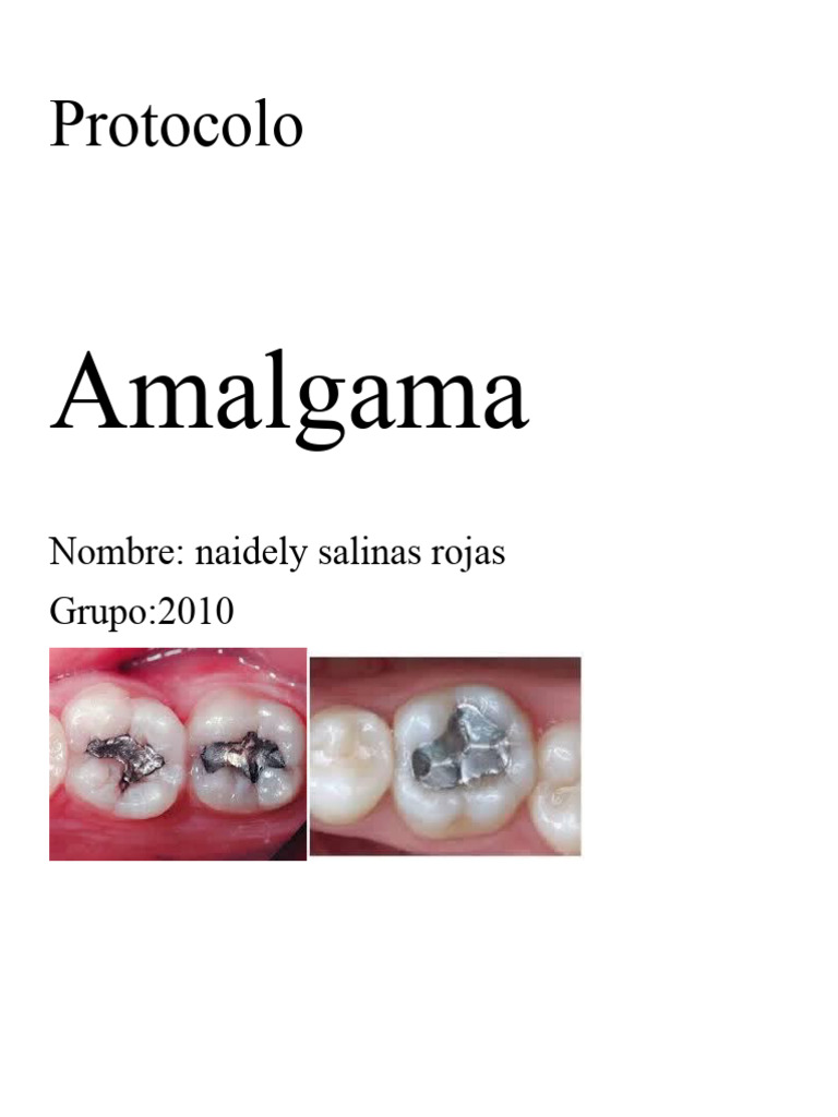 Protocolo de colocación de amalgama dental | PDF | Estaño | Cobre