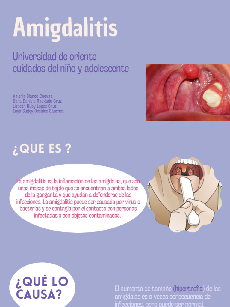 Amigdalitis 1 | PDF | Penicilina | Alergia