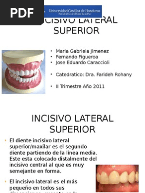 Anatomía Dental Del Incisivo Central Maxilar Anatomía Dental General