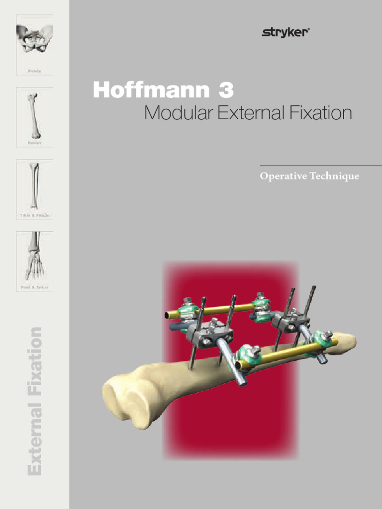 Hoffmann 3 | PDF | Magnetic Resonance Imaging | Orthopedic Surgery