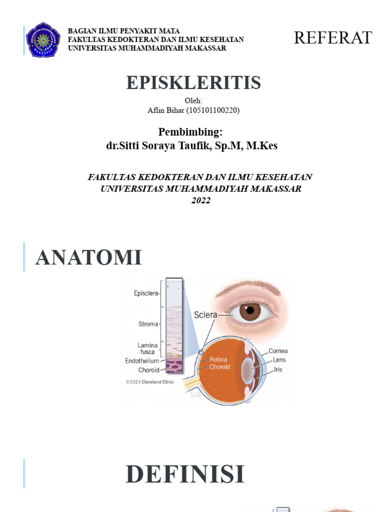 Episkleritis: Referat | PDF