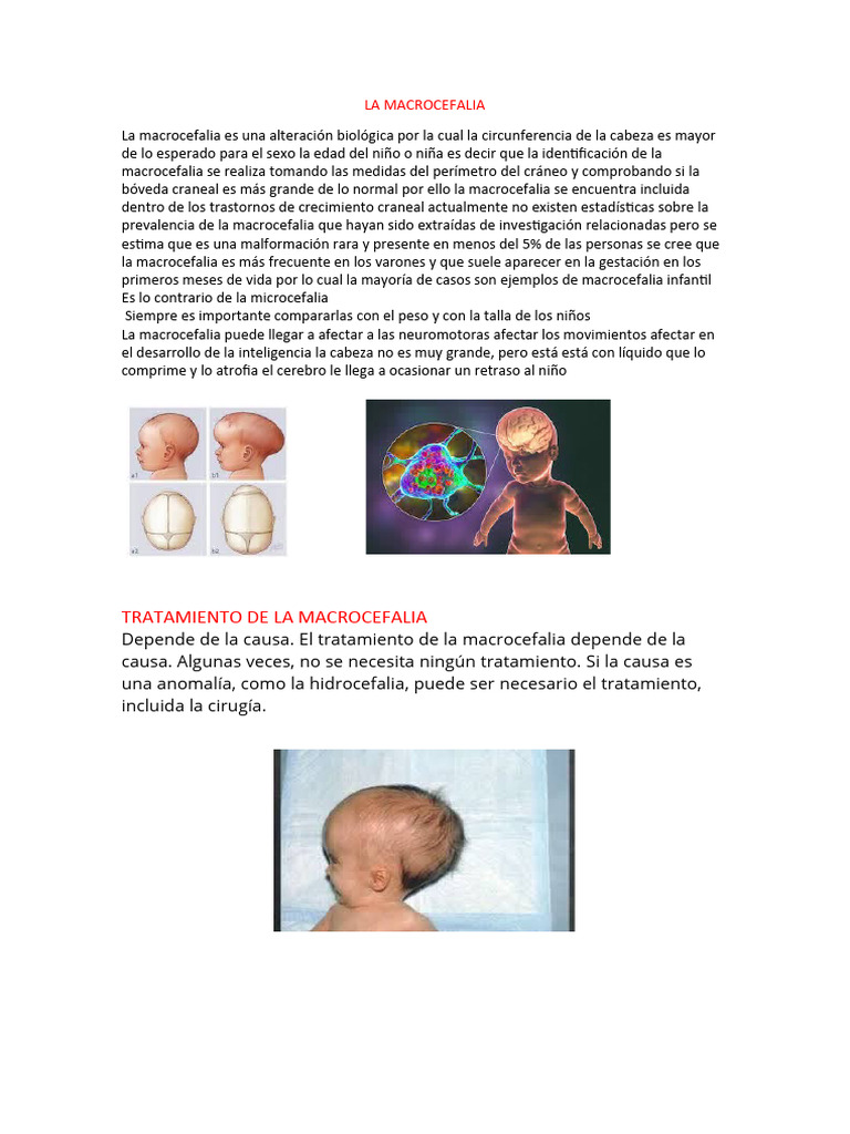 La Macrocefalia | PDF | Ciencia y matemáticas