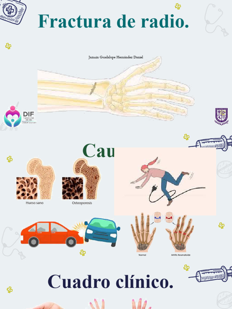Fractura de Radio | PDF | Codo | Hombro Fractura de Radio | PDF | Codo | Hombro