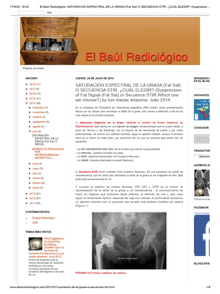 Fat Sat vs STIR en Resonancia Magnética | PDF | Imagen de resonancia ...