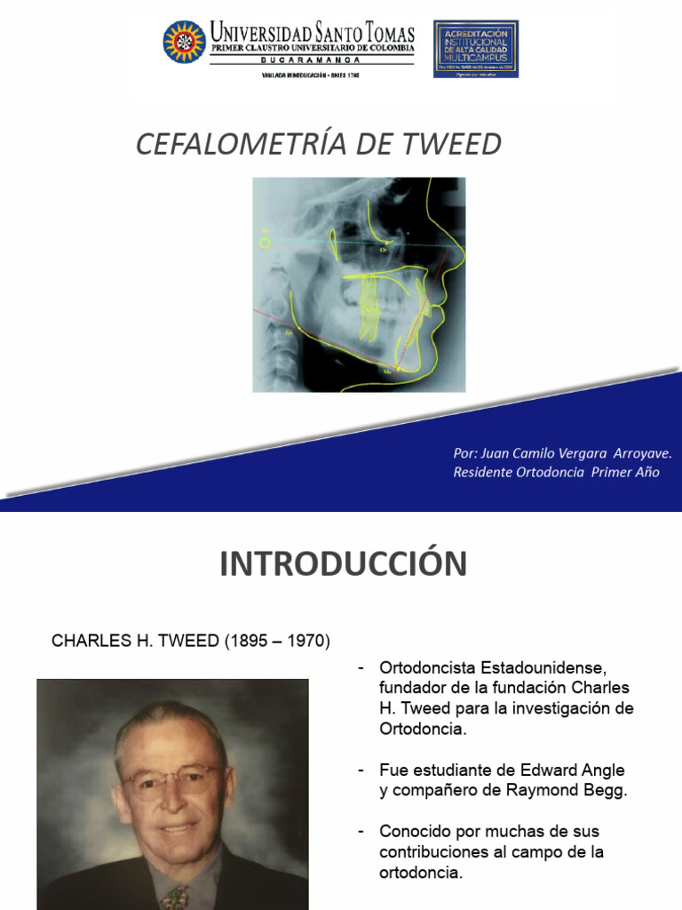 Clase 5. Analisis Tweed | PDF | Ramas de Odontología