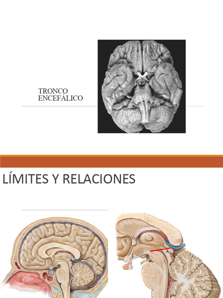 Clase Tronco Encefalico y Cerebelo | PDF | Cerebelo | Cerebro