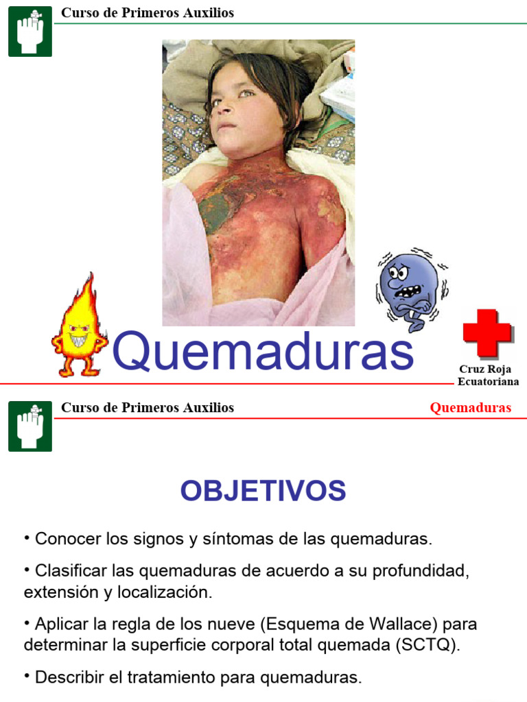 Curso de Primeros Auxilios para Quemaduras | PDF | Quemar | Primeros auxilios