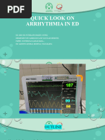 Ventricular Tachycardia - Monomorphic VT - LITFL | PDF ...
