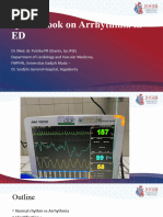 Ventricular Tachycardia - Monomorphic VT - LITFL | PDF ...
