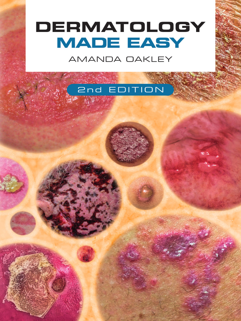 Dermatology: Made Easy | Download Free PDF | Skin Cancer | Dermatitis