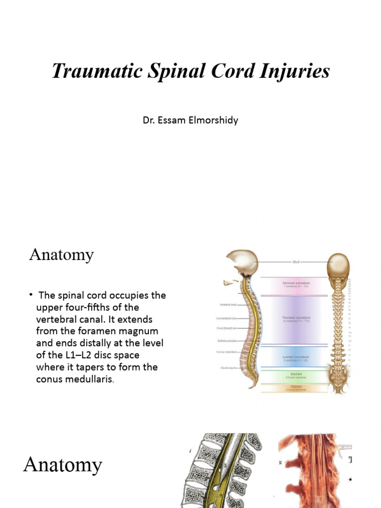Spinal Cord Injuries | PDF | Vertebral Column | Spinal Cord