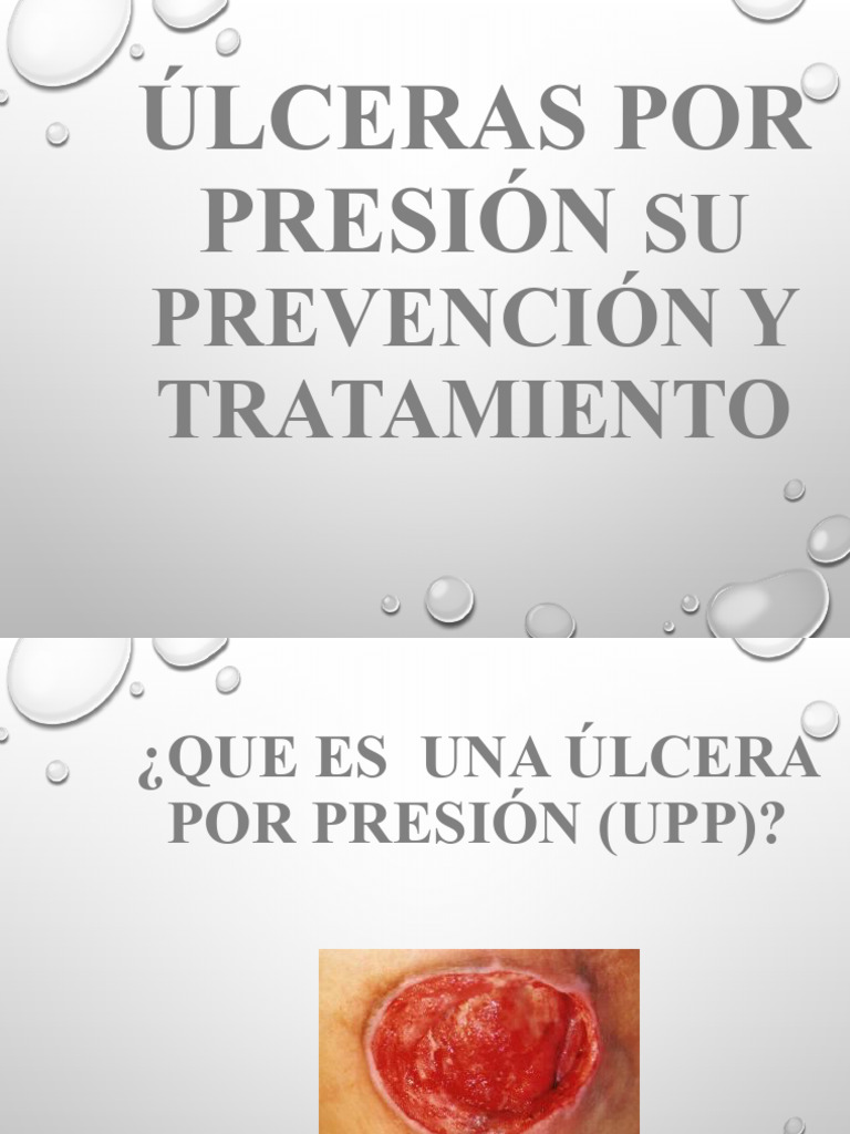 Ulceras Por Presion | PDF
