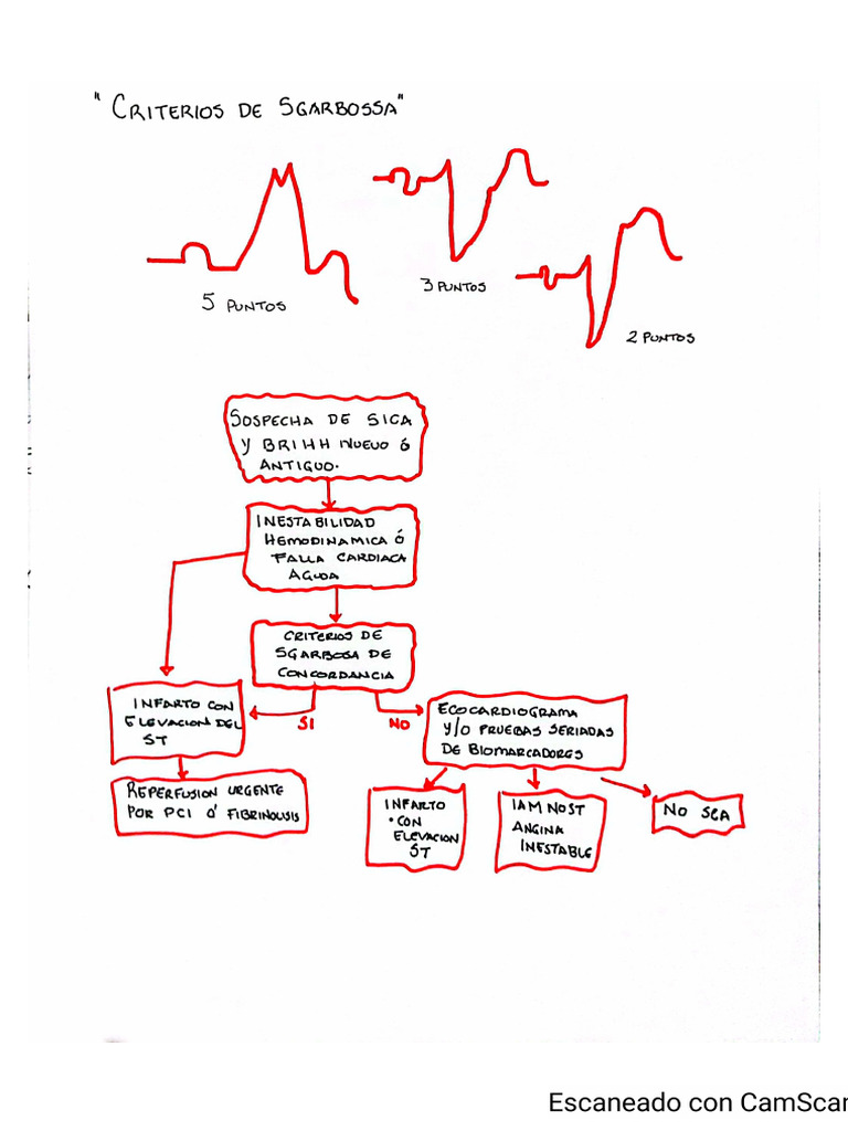 Criterios de Sgarbossa - 3 | PDF