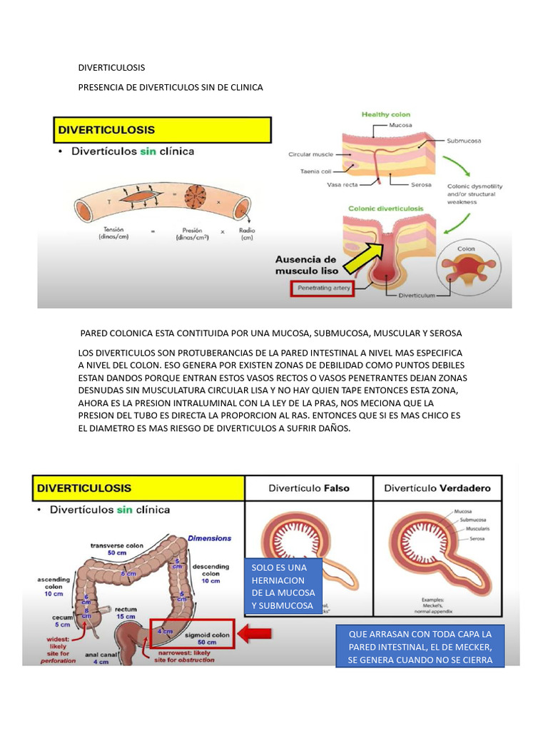 DIVERTICULAR | PDF