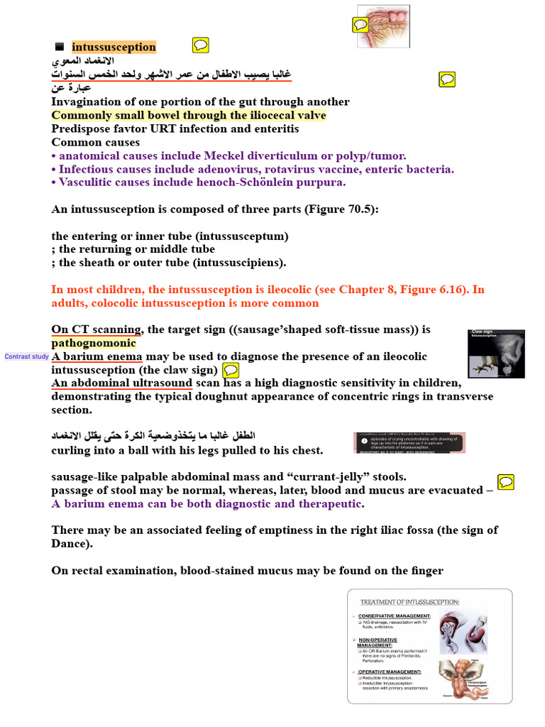 Pediatric Intussusception Diagnosis and Signs | PDF | Science & Mathematics