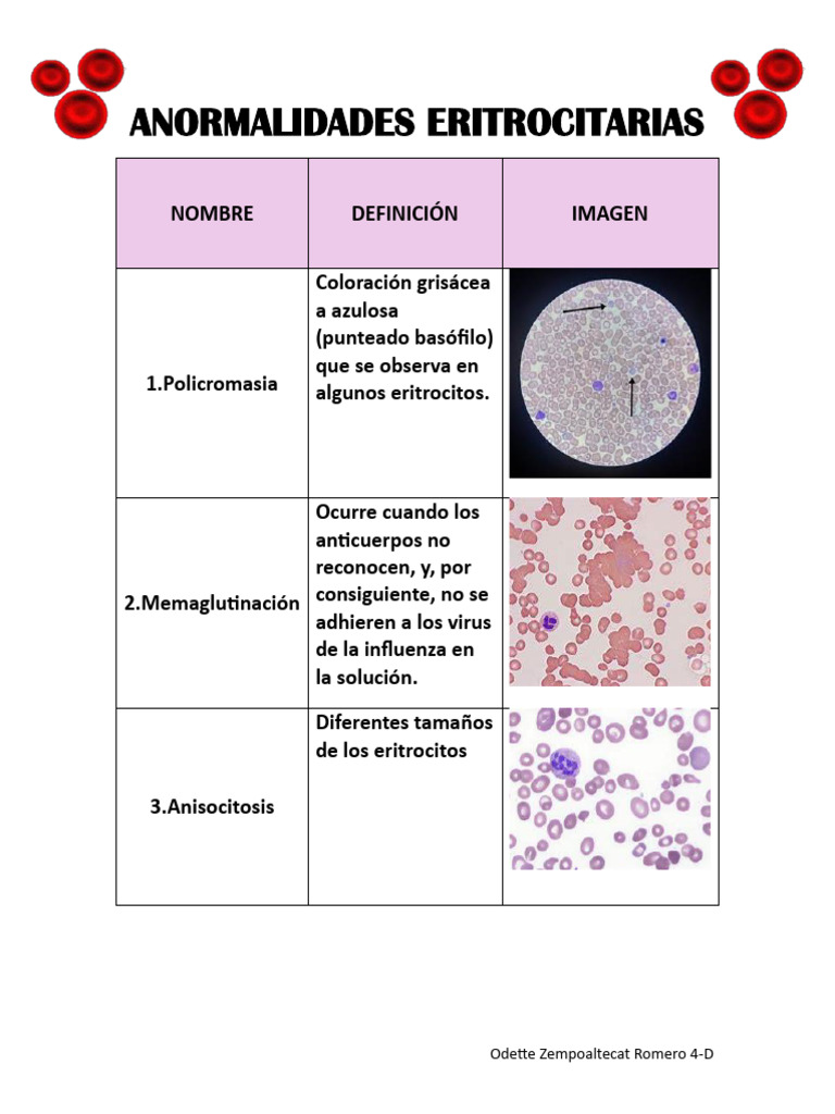 Análisis de Anormalidades Eritrocitarias | PDF
